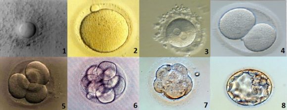Fecundación in vitro (FIV/ICISI) - InvitroRed
