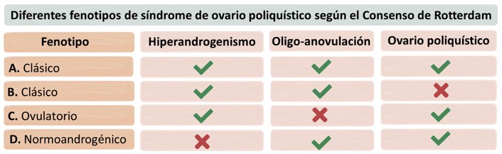 Síndrome de ovario poliquístico - InvitroRed