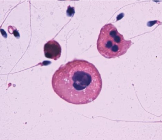 Cultivo seminal - InvitroRed